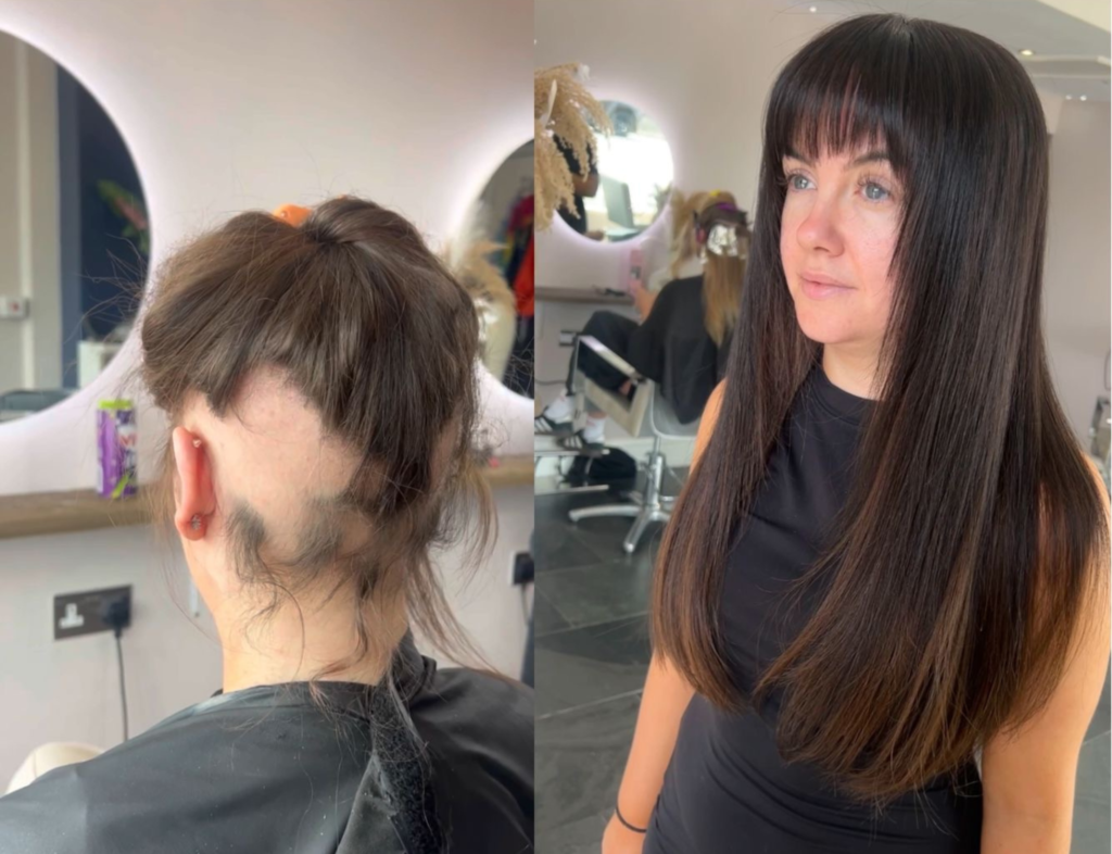 Hair Loss & Replacement Systems – Elysium Hair Salon